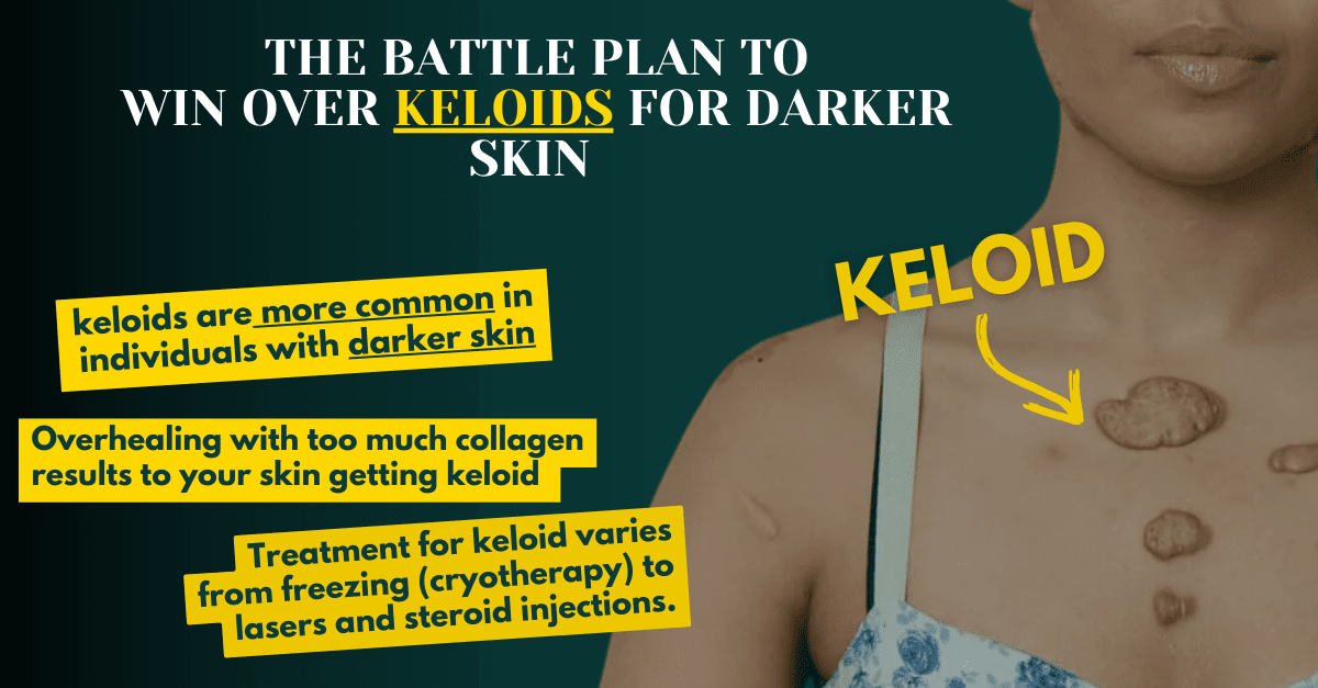 Keloids on Dark Skin: Safe Treatments, Prevention & Scar Management ...